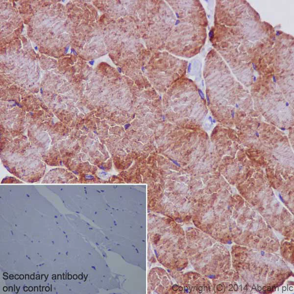Desmin抗体- Cytoskeleton Marker (ab15200)| Abcam中文官网