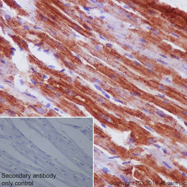 Anti-Desmin antibody, cytoskeleton marker (ab15200) | Abcam