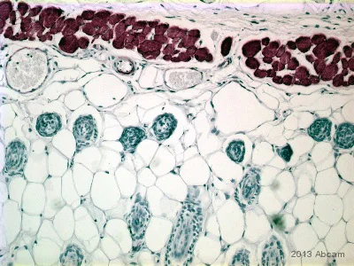 Anti-Desmin antibody, cytoskeleton marker (ab15200) | Abcam