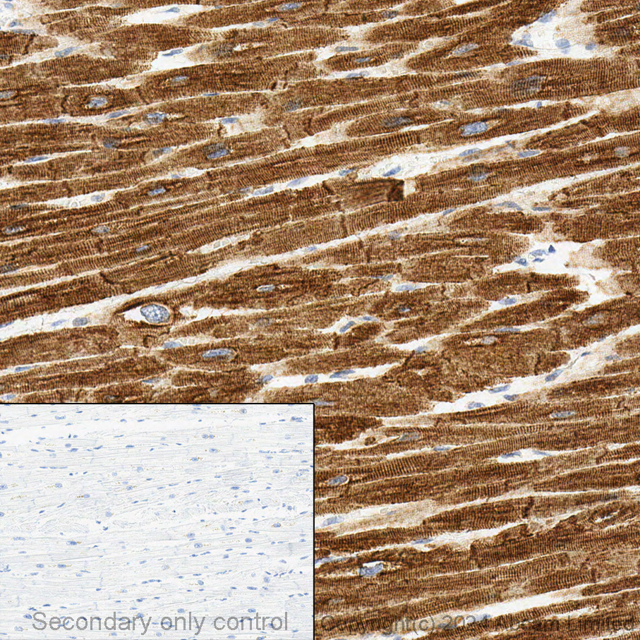 Anti-Desmin antibody, cytoskeleton marker (ab15200) | Abcam