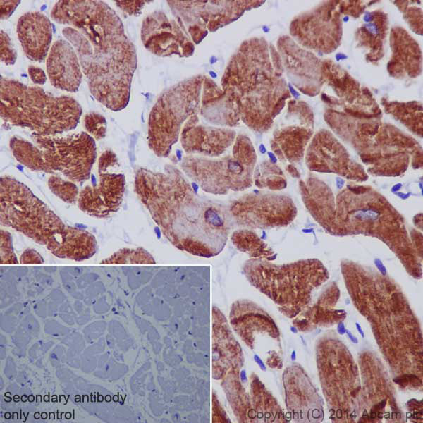 Anti-Desmin antibody - Cytoskeleton Marker (ab15200) | Abcam