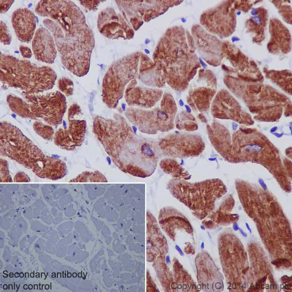 Desmin抗体- Cytoskeleton Marker (ab15200)| Abcam中文官网