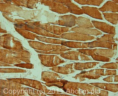 Desmin抗体[DE-U-10] - Cytoskeleton Marker (ab6322)| Abcam中文官网