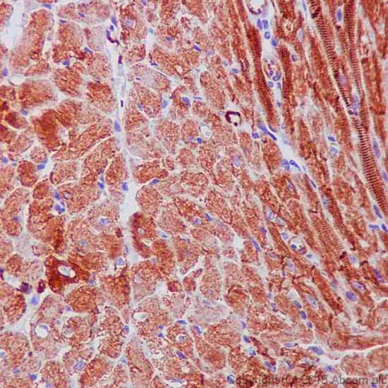 Desmin抗体[DE-U-10] - Cytoskeleton Marker (ab6322)| Abcam中文官网