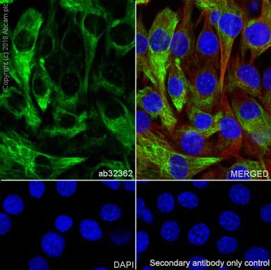 Desmin抗体[Y66] - Cytoskeleton Marker (ab32362)| Abcam中文官网