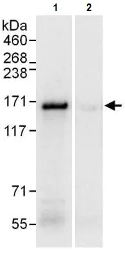 Anti-Desmoglein 2/DSG2 antibody (ab226184) | Abcam