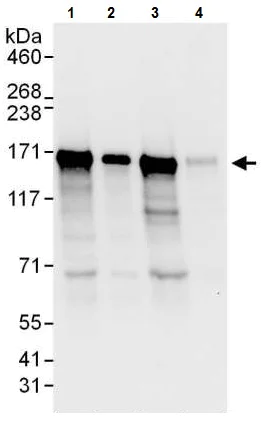 Anti-Desmoglein 2/DSG2 antibody (ab226184) | Abcam