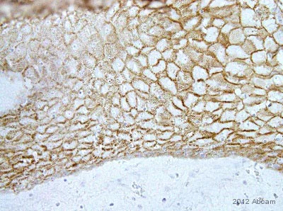 Desmoglein 3/PVA抗体[5G11] (ab14416)| Abcam中文官网