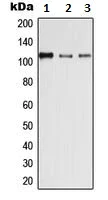 Anti-Desmoglein 4 antibody (ab230787) | Abcam