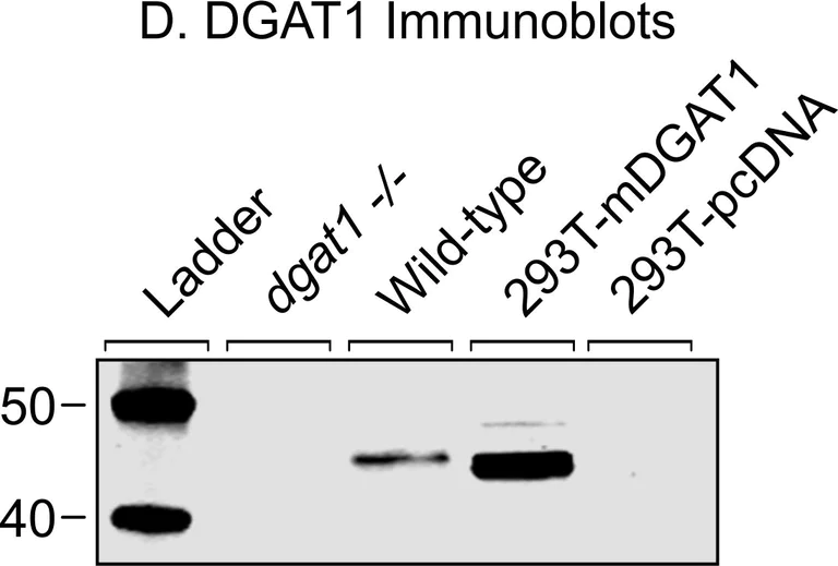 Anti-DGAT1 antibody (ab59034) | Abcam