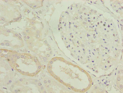 Anti-DHHC-12 antibody (ab237688) | Abcam