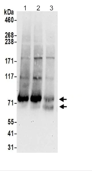 Anti-DHHC-5 antibody (ab200572) | Abcam