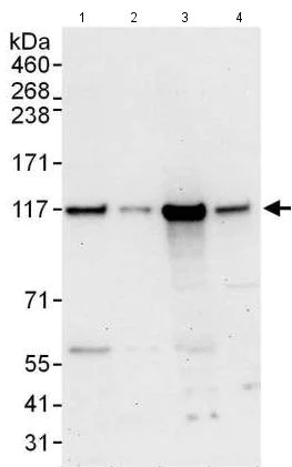 Anti-DIS3 antibody (ab176802) | Abcam