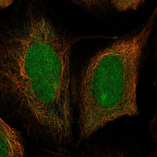 Anti-DIS3 antibody (ab223767) | Abcam