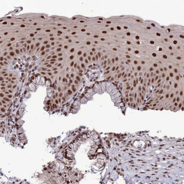 Anti-DIS3 antibody (ab223767) | Abcam