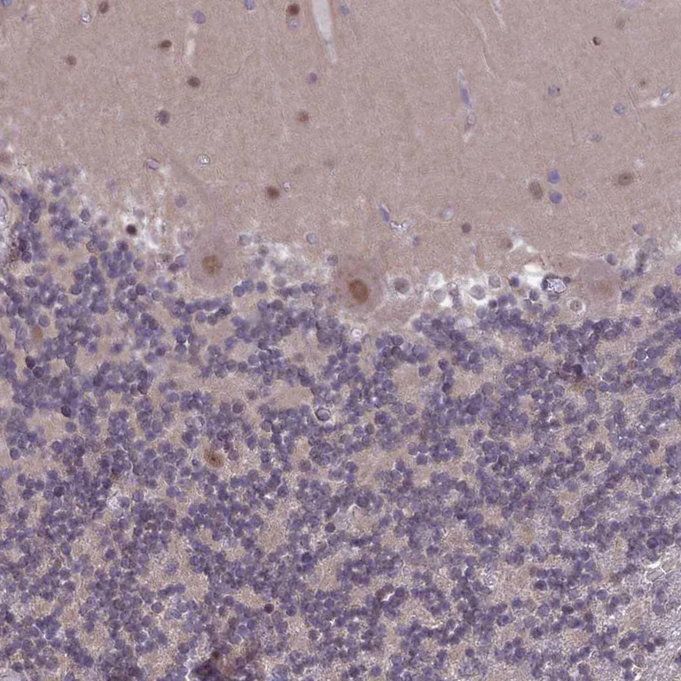 Anti-DIS3 antibody (ab223767) | Abcam