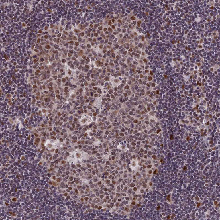 Anti-DIS3 antibody (ab223767) | Abcam