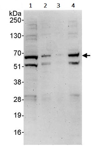 Anti-DKC1/Dyskerin antibody (ab245559) | Abcam
