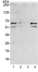 Anti-DKC1/Dyskerin antibody (ab93777) | Abcam