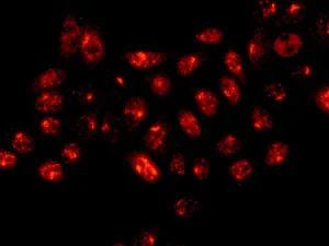 Anti-DKC1/Dyskerin antibody [EPR10398] (ab156006) | Abcam