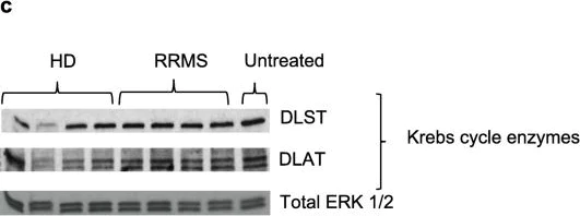 Anti-DLST antibody [EPR13318(B)] (ab177934) | Abcam