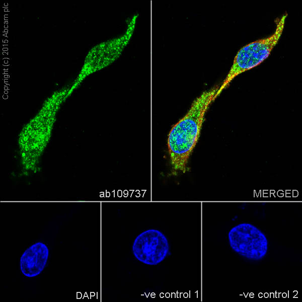 Anti-Dlx5 antibody [EPR4488] (ab109737) | Abcam