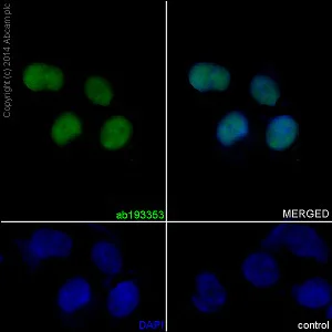 Anti-DNA Ligase IV/LIG4 antibody [EPR16531] KO tested (ab193353) | Abcam