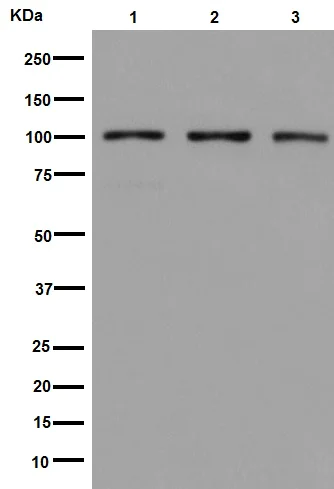 Anti-DNA Ligase IV/LIG4 antibody [EPR16531] KO tested (ab193353) | Abcam