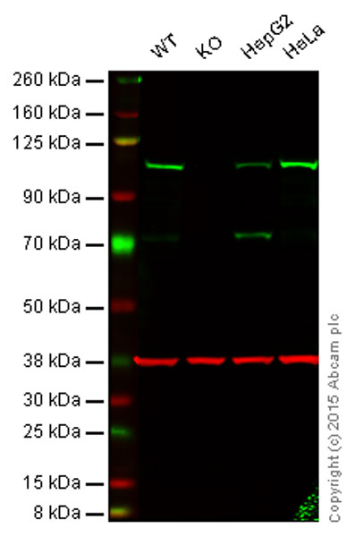 Anti-DNA Ligase IV/LIG4 antibody [EPR16531] KO tested (ab193353) | Abcam