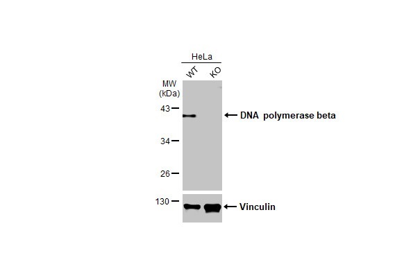 Anti-DNA polymerase beta antibody [HL1512] - BSA and Azide free ...
