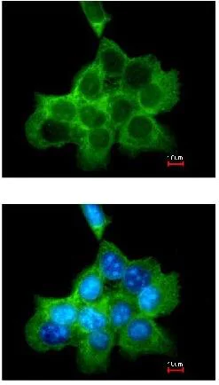 Anti-DOCK180 antibody (ab97325) | Abcam