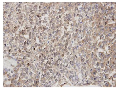 Anti-DOCK180 antibody (ab97325) | Abcam