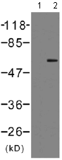 Anti-DOK1 (phospho Y362) antibody (ab75742) | Abcam