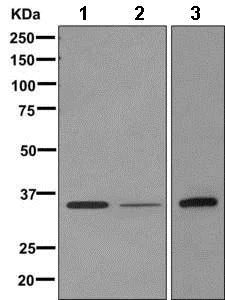 Anti-DOK5 antibody [EPR9923(B)] (ab168343) | Abcam