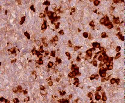Donkey Anti-Goat IgG H&L (HRP polymer) (ab214881) | Abcam