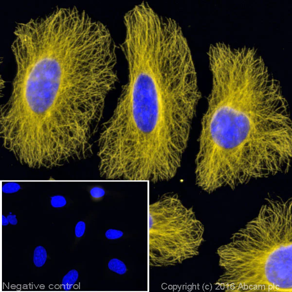 Donkey Anti-Mouse IgG H&L (Alexa Fluor® 568) (ab175472) | Abcam