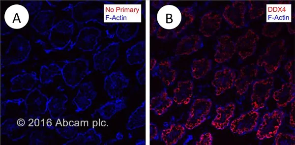 Donkey Anti-Rabbit IgG (Alexa Fluor® 555) preadsorbed secondary ...