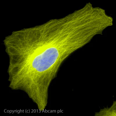 Donkey Anti Rabbit (IgG) secondary antibody preadsorbed Alexa Fluor® 555