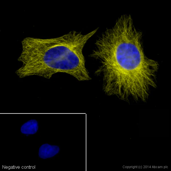 Donkey Anti-Rat IgG (Alexa Fluor® 555) preadsorbed secondary antibody ...