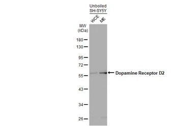 Anti-Dopamine D2 Receptor antibody [HL1478] - BSA and Azide free ...