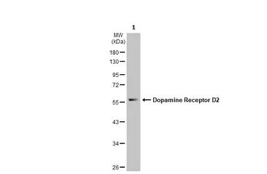Anti-Dopamine D2 Receptor antibody [HL1478] - BSA and Azide free ...