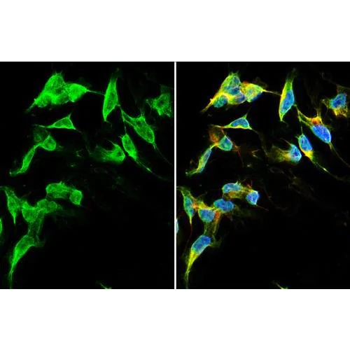 Anti-Dopamine Receptor D2 antibody [HL1584] (ab317095) | Abcam中文官网
