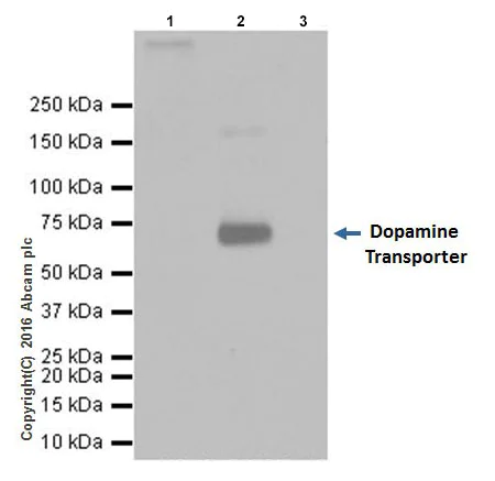 Anti-Dopamine Transporter antibody [EPR19695] (ab184451) | Abcam
