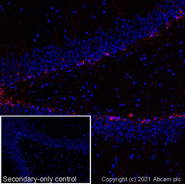 Anti-Doublecortin antibody. Rabbit polyclonal (ab18723) | Abcam