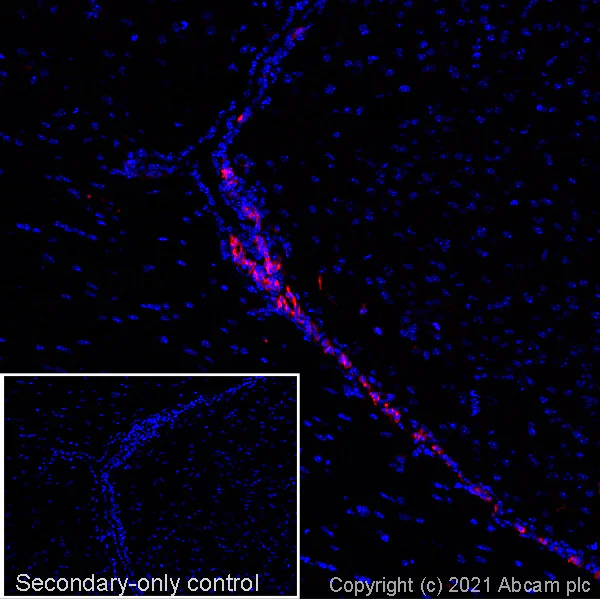 Anti-Doublecortin antibody. Rabbit polyclonal (ab18723) | Abcam