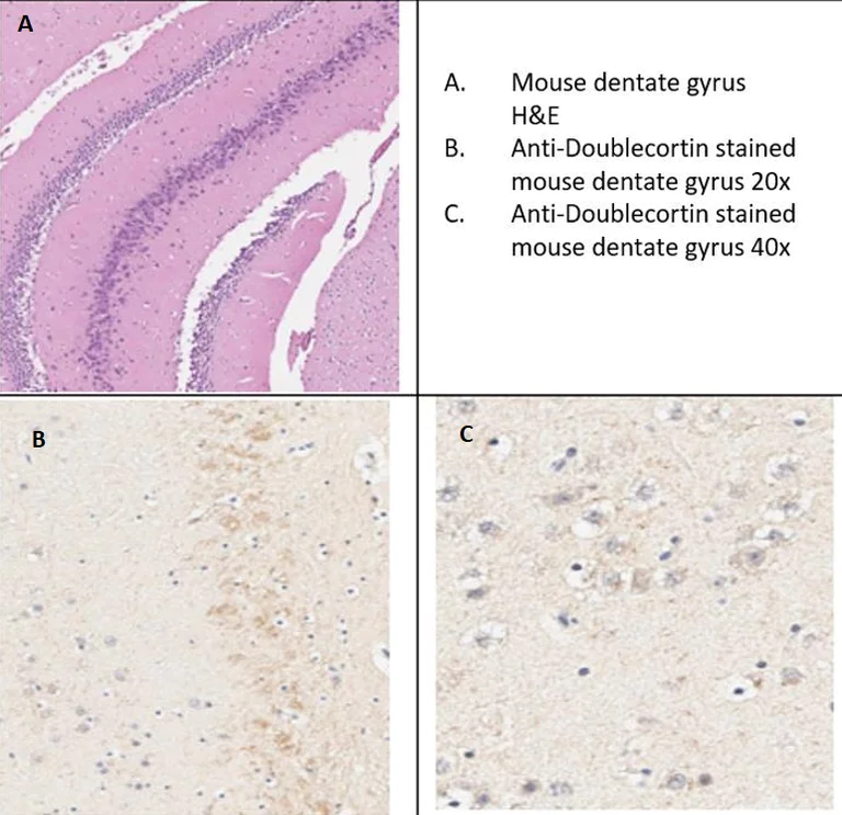 Anti-Doublecortin antibody (ab235153) | Abcam