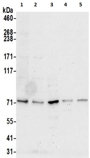 Anti-DPP3 antibody (ab217127) | Abcam