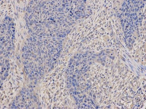 Anti-DRP1 antibody - C-terminal (ab180769) | Abcam