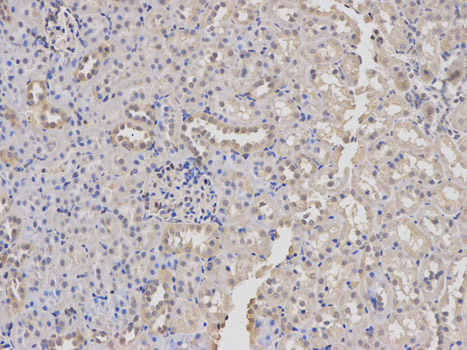 Anti-DRP1 antibody - C-terminal (ab180769) | Abcam