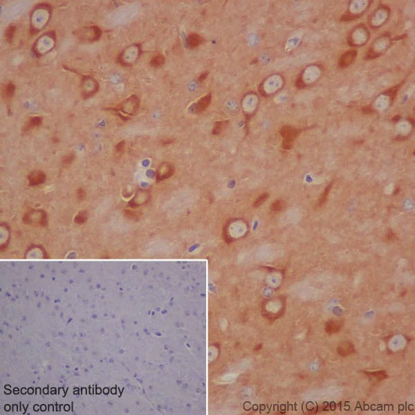 DRP1抗体[EPR19274] (ab184247)| Abcam中文官网